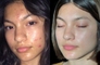 Curology Reviews | Skincare Treatments & Results | Curology